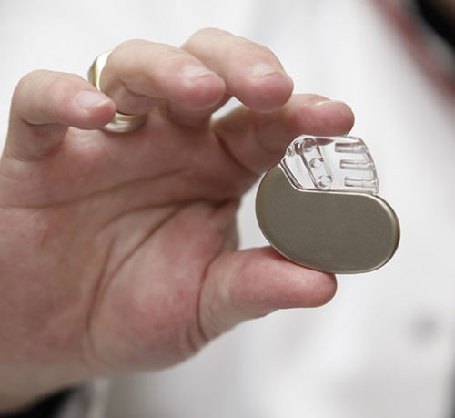 Cardiac Testing Services in Barrie | Georgian Cardiology Associates